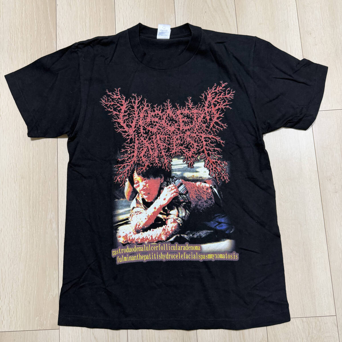 【バンドTシャツ】VISCERA INFEST / Gastroduodenalulcer… サイズ：M / カラー：ブラック ...