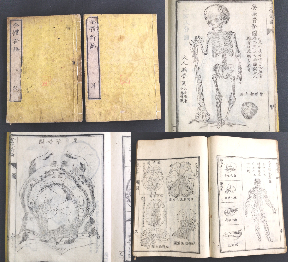 Y479 医学 解剖学 絵入 全体新論 全2冊揃 骸骨 人骨図ほか 身体 動物 医書 江戸時代物 浮世絵UKIYOE 木版画 骨董 古美術 古 ...